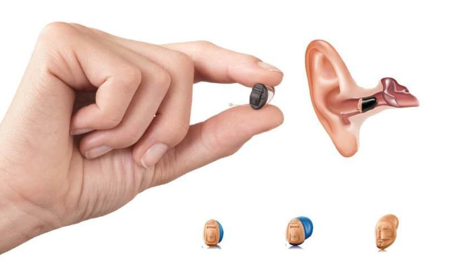 Completely In-the-Canal (CIC) Hearing Aid FAQs 2024 – Vivtone